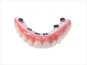 Solitaire Smile Dental Lab